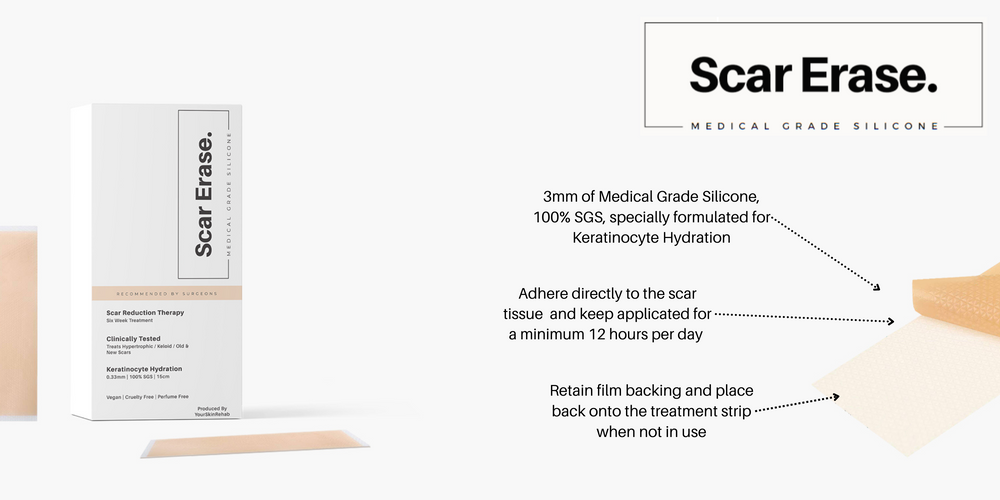 In The News | Scar Erase