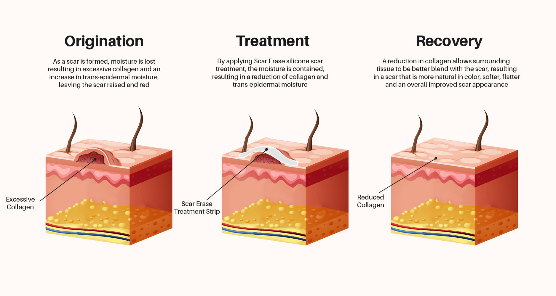 Science | Scar Erase