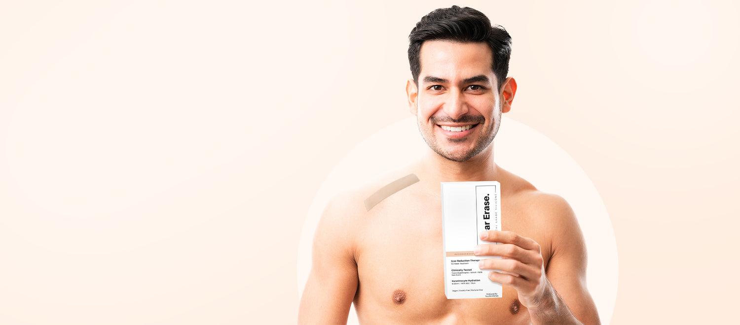 Scar Erase: Minimise Scars | The Future of Scar Treatment